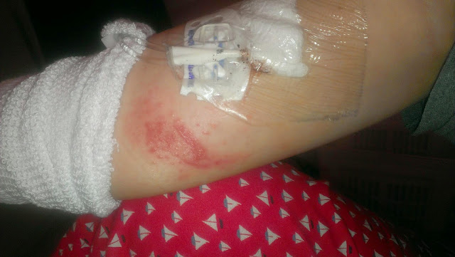 Melissa's Lyme Life: PICC line problems