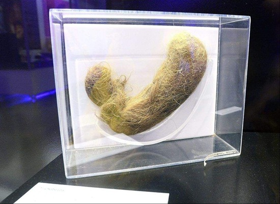 Alizul: 10 DISTURBING MEDICAL CURIOSITIES