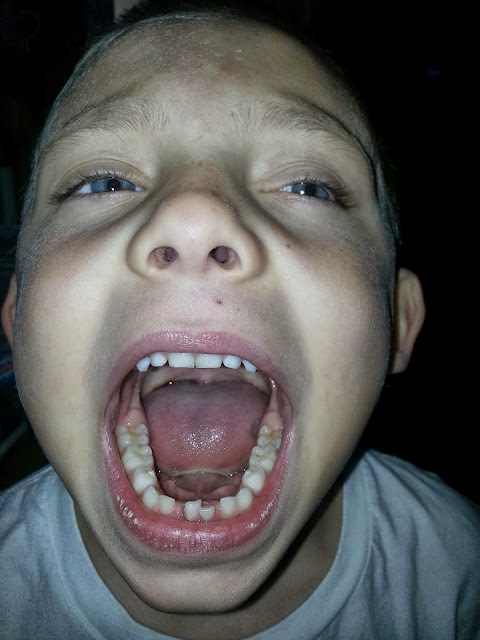 Kome What May & Love It!: Kade's Wiggly Tooth