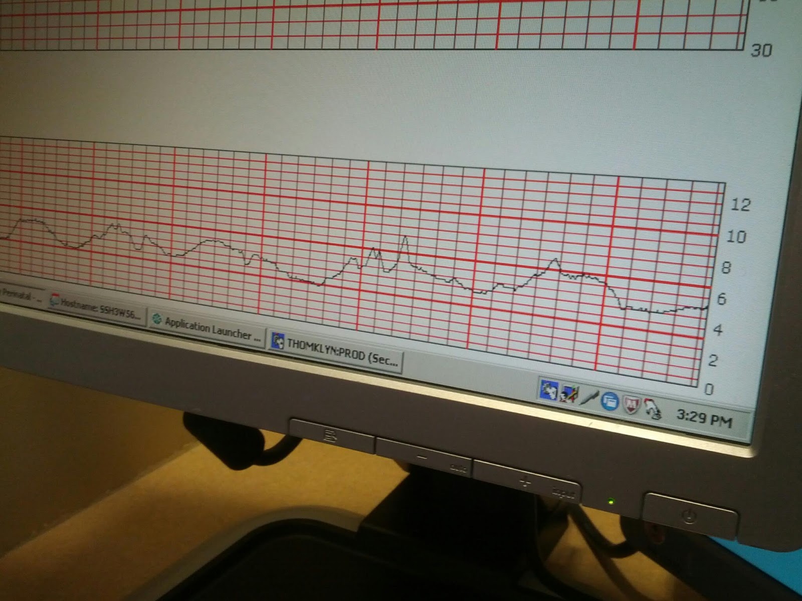 New Adventures of Old TLyu: Tocodynamometer...