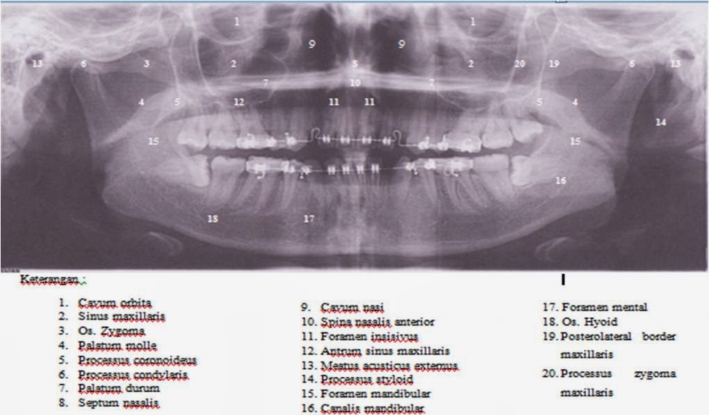 2013 ~ Dent-ias || notes
