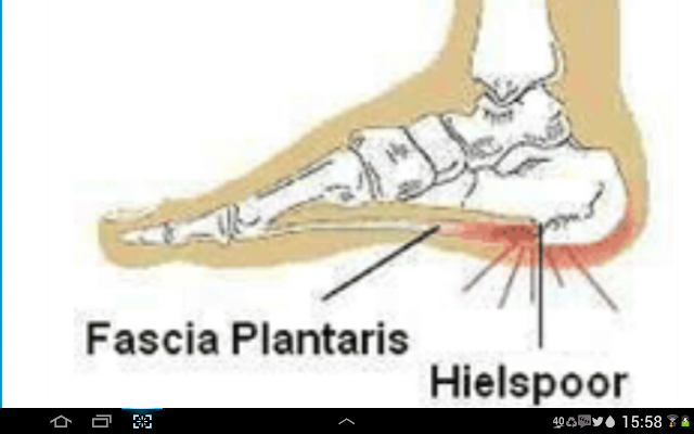 Oefentherapie Zaanstad: Pijn onder de voet