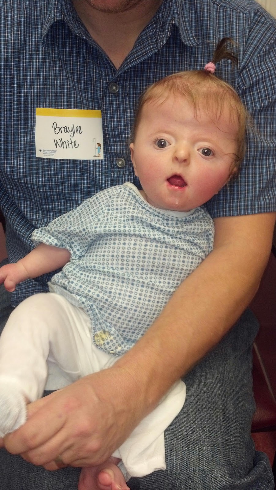 Braylee Rae White: Surgery