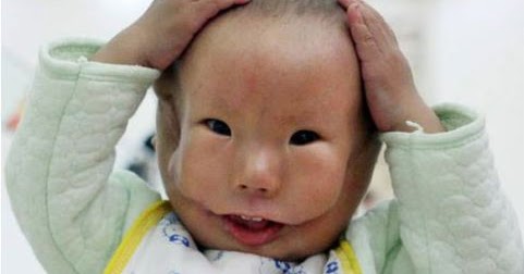 Photos: Baby in China Born with Double Face - HeThatKnows