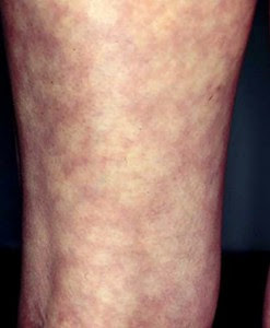 Stellaaaaa?!: July 2014