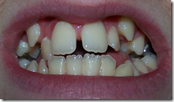 Daniel 'The' Pope: All about my teeth