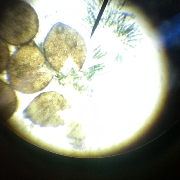 Sordaria | Project Noah