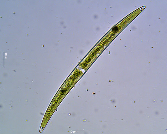 Closterium | Project Noah