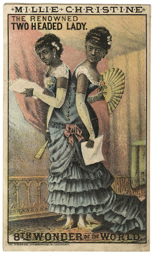 Millie-Christine: The Renowned Two Headed Lady — Google Arts & Culture