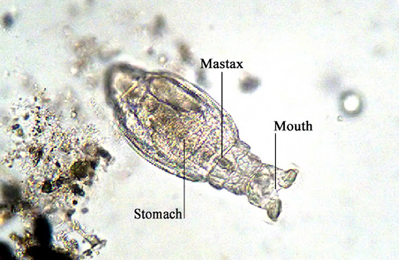 Rotifer Under Microscope