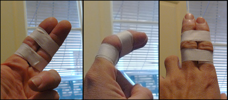 ESPACIO, AMOR Y LOCURA: TENDINITIS DE LA EXTREMIDAD SUPERIOR -VIII ...