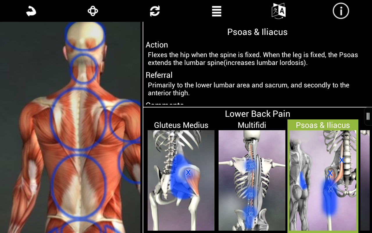Muscle Trigger Point Anatomy – Apps para Android no Google Play