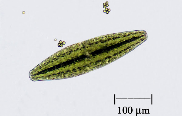 Desmid | Project Noah